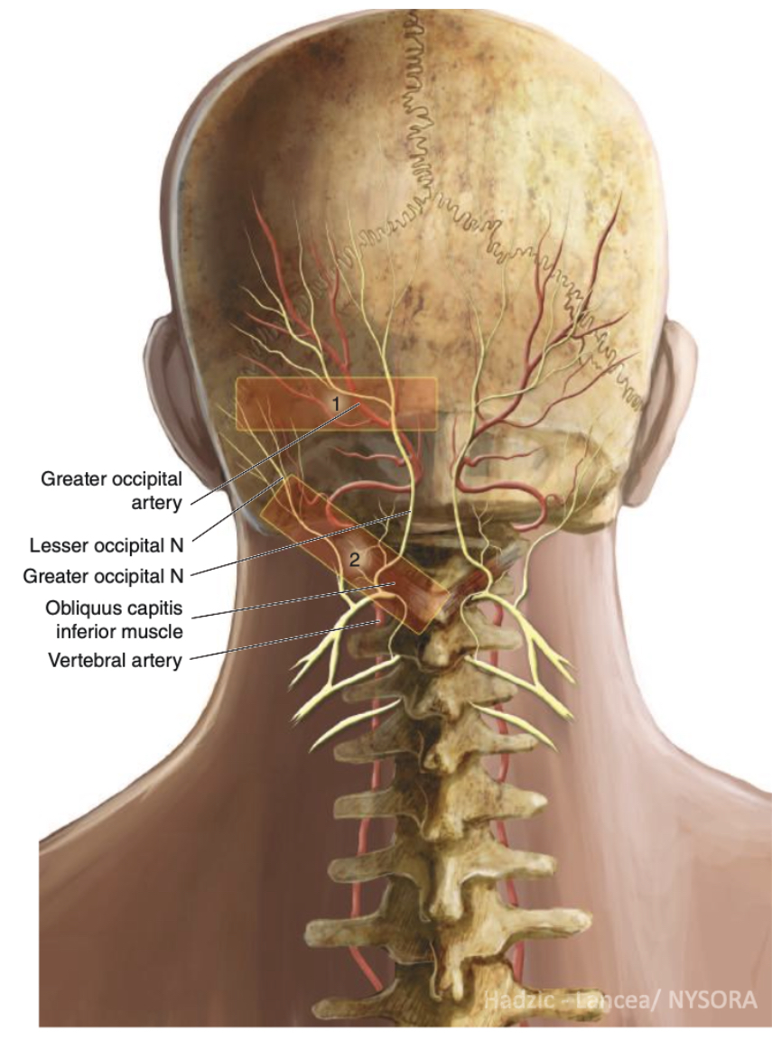 Entenda o que é Scalp Block - Blog Propofando
